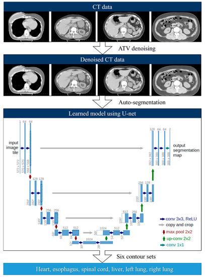 Impact of Denoising on Deep-Learning-Based Automatic Segmentation Framework for Breast Cancer ...