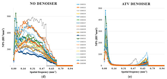 Impact of Denoising on Deep-Learning-Based Automatic Segmentation ...