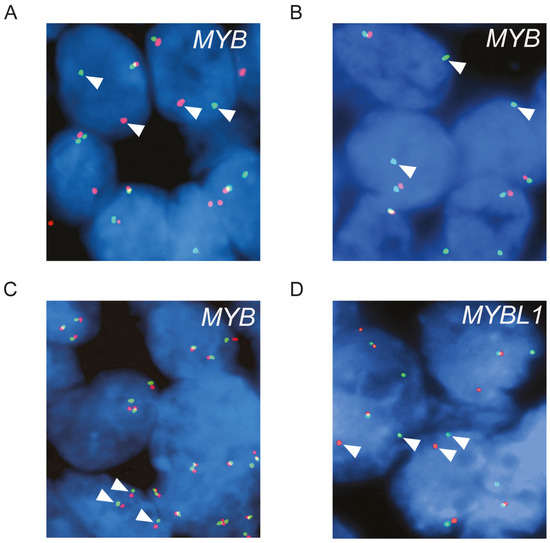 Rearrangements, Expression, and Clinical Significance of MYB and MYBL1 ...