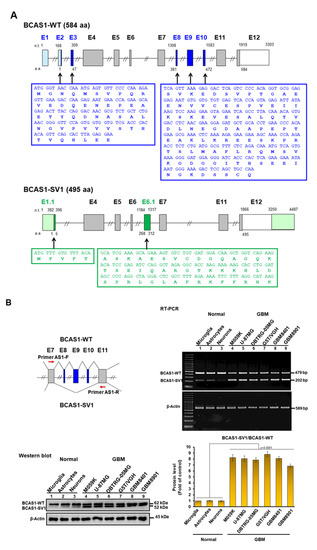 Cancers | Free Full-Text | A Novel Splice Variant of BCAS1 Inhibits β ...