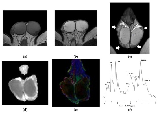 An Overview of the Role of Multiparametric MRI in the Investigation of ...
