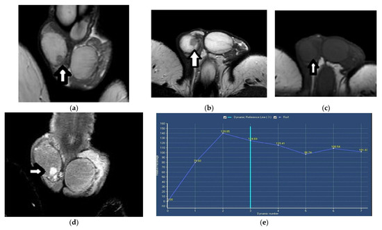 An Overview of the Role of Multiparametric MRI in the Investigation of ...