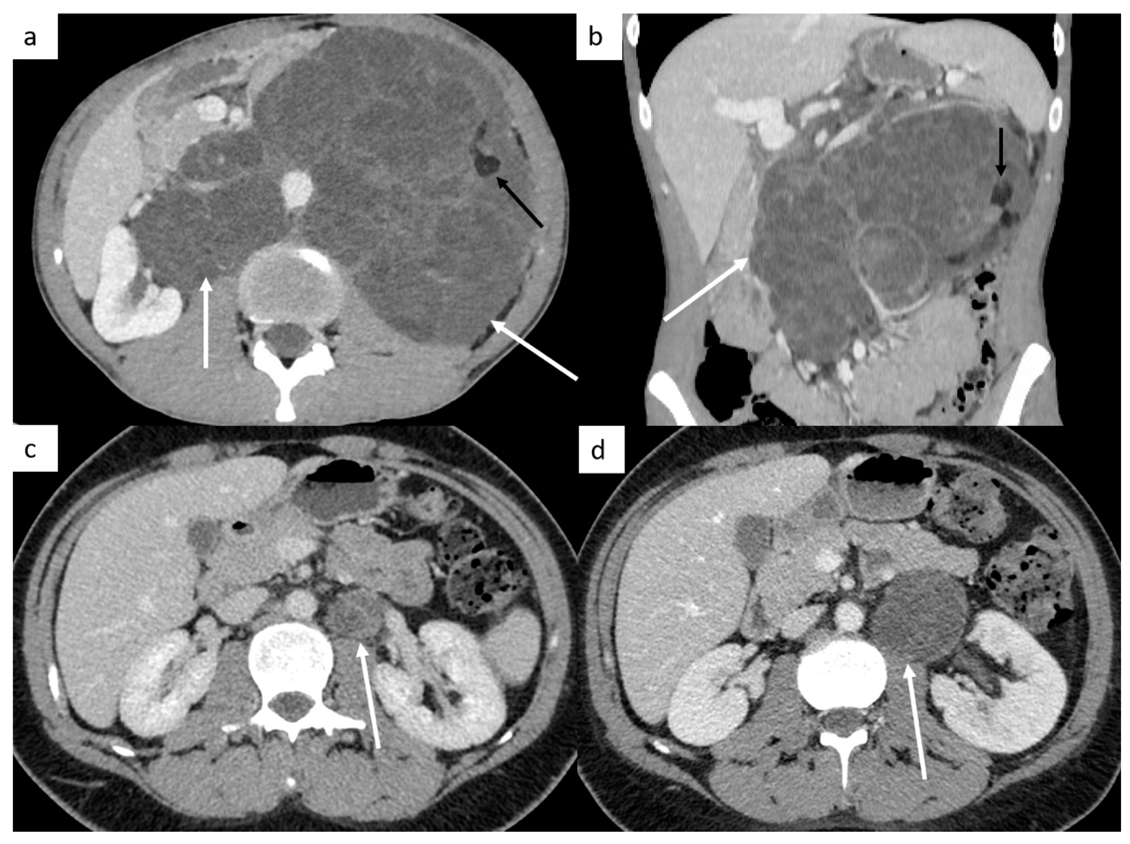 Cancers Free Full Text The Role Of Ct In The Staging And Follow Up