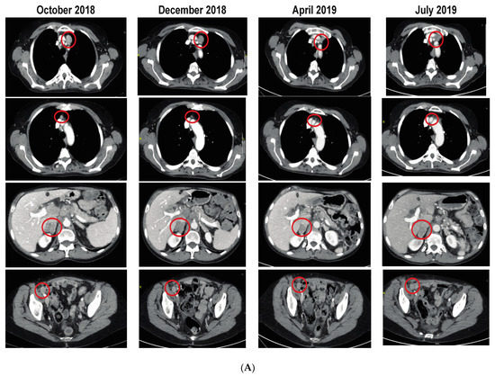 BMS-986158, a Small Molecule Inhibitor of the Bromodomain and ...