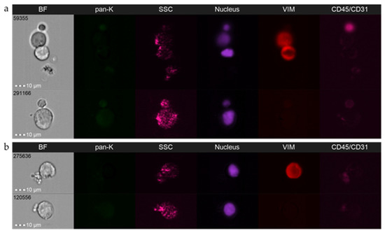 Detection and Characterization of Circulating Tumor Cells Using Imaging ...