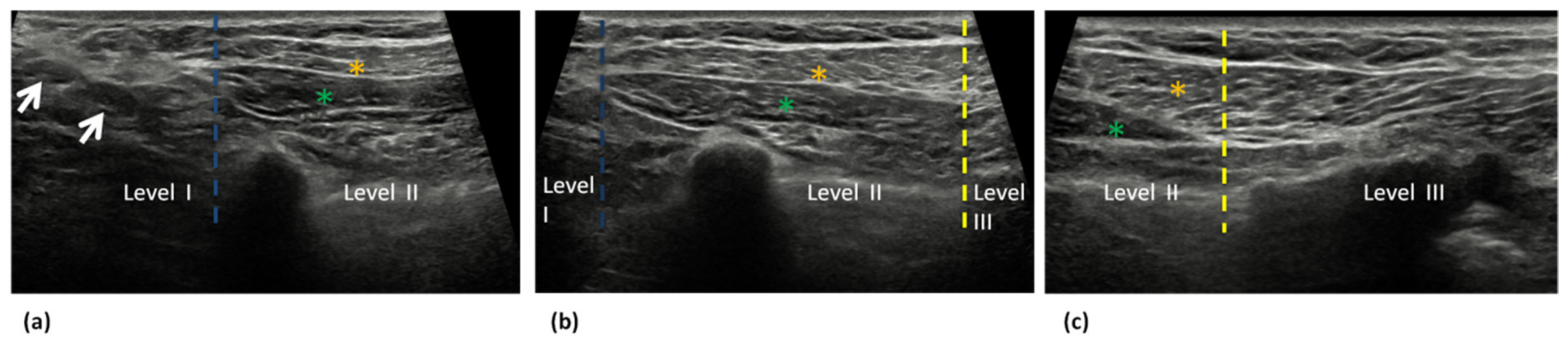 Axillary Lymph Nodes Levels