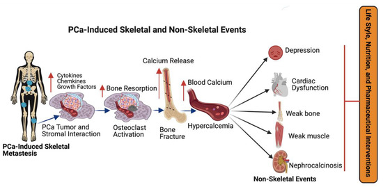 Bone Health Management in the Continuum of Prostate Cancer Disease