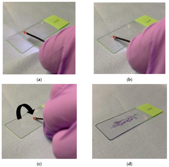 Clinical Utility of Rapid On-Site Evaluation of Touch Imprint Cytology ...