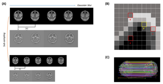 Generation and Evaluation of Synthetic Computed Tomography (CT) from Cone-Beam CT (CBCT) by ...