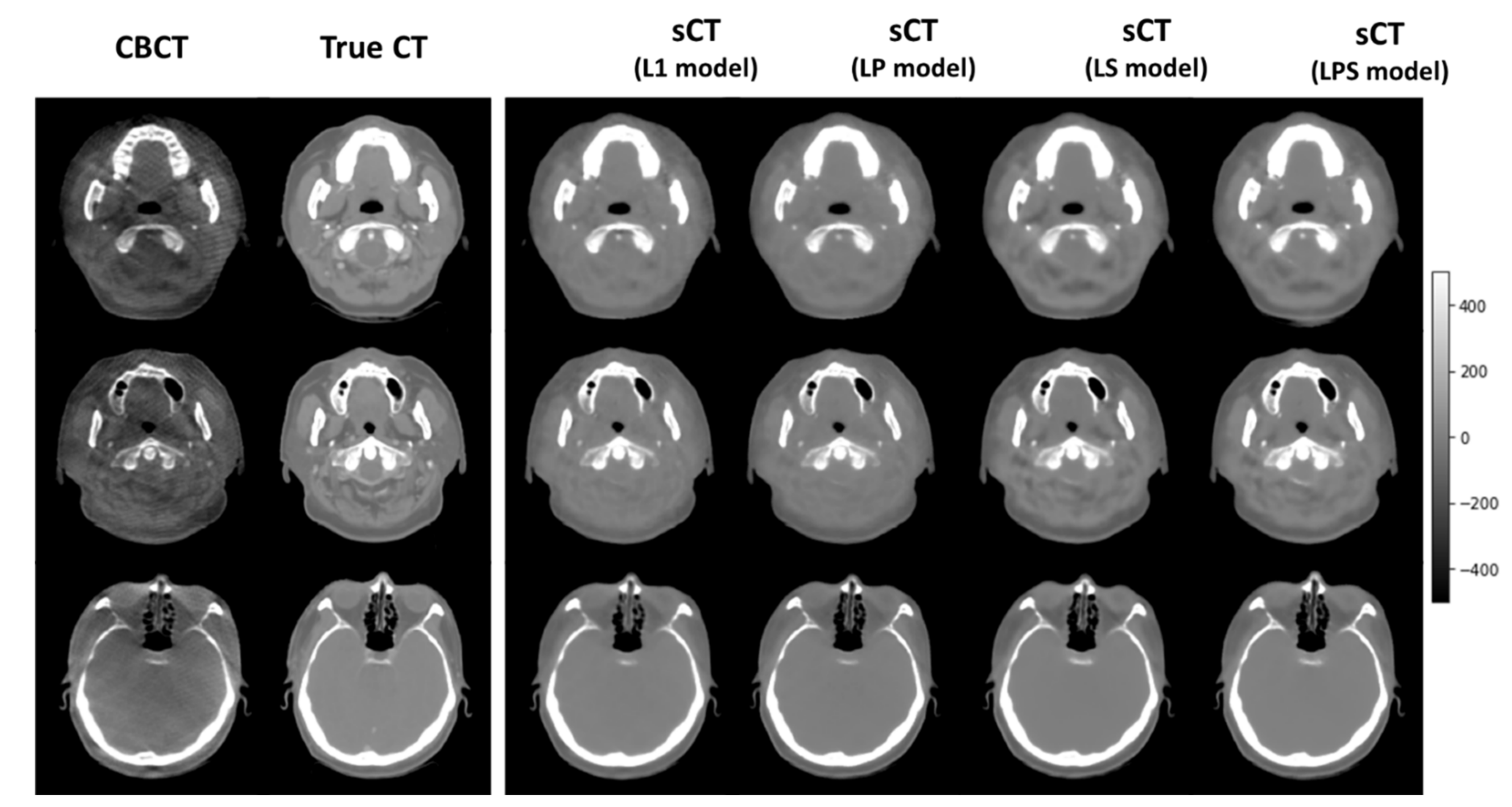 Generation and Evaluation of Synthetic Computed Tomography (CT) from Cone-Beam CT (CBCT) by ...