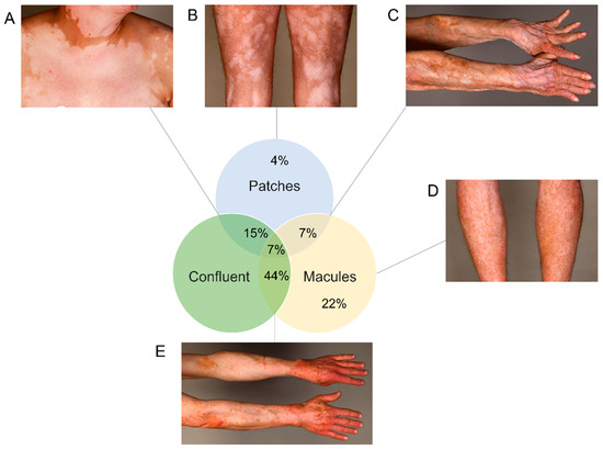 Clinical Presentation and Prognostic Features in Patients with ...