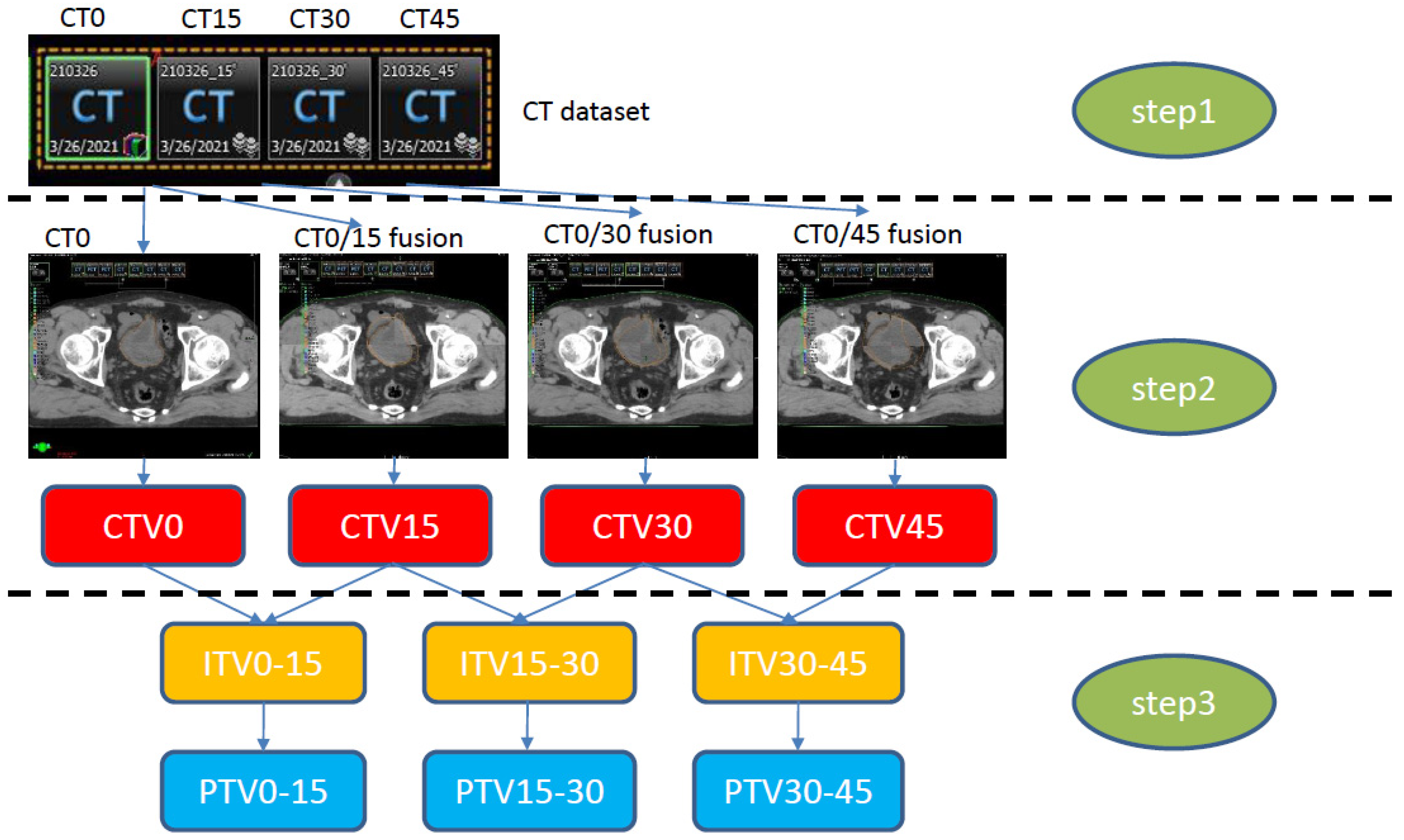 Optimized Adaptive Radiotherapy with Individualized Plan Library for ...