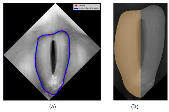 Assessment of Vocal Fold Stiffness by Means of High-Speed ...