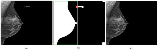 Automated Assessment of Breast Positioning Quality in Screening Mammography