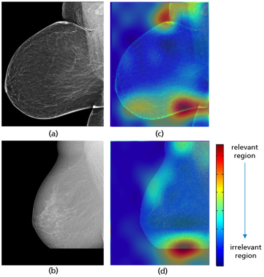 Automated Assessment of Breast Positioning Quality in Screening Mammography