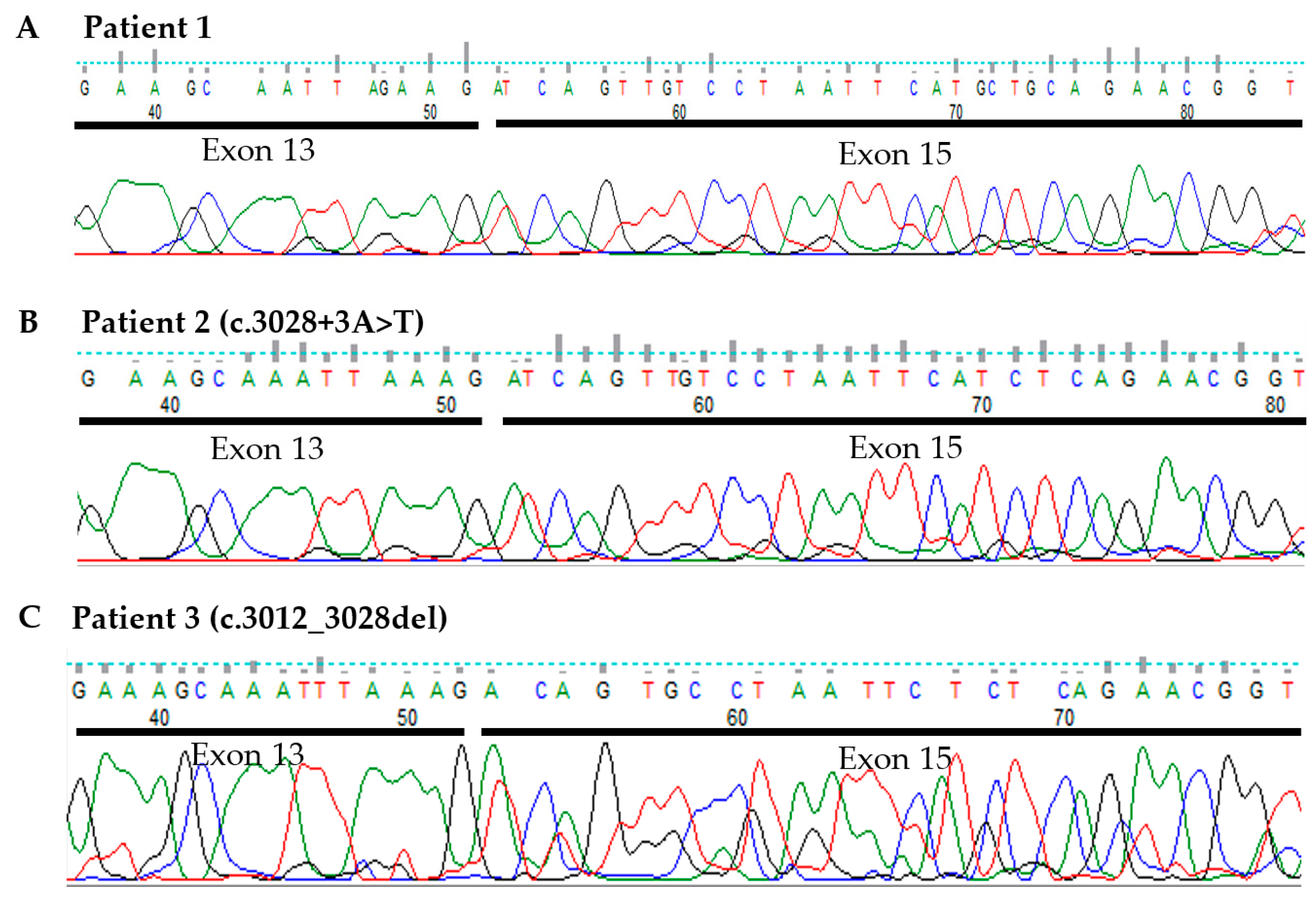 Identification of Novel MET Exon 14 Skipping Variants in Non-Small Cell ...
