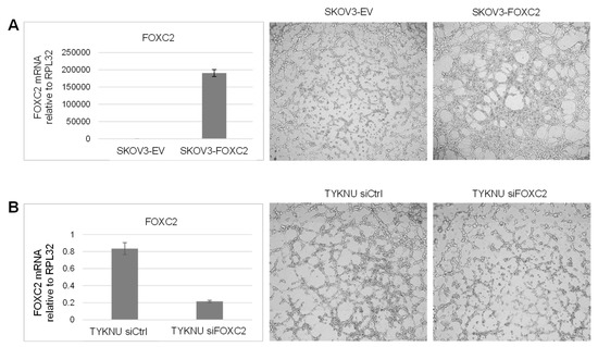 FOXC2 Promotes Vasculogenic Mimicry in Ovarian Cancer