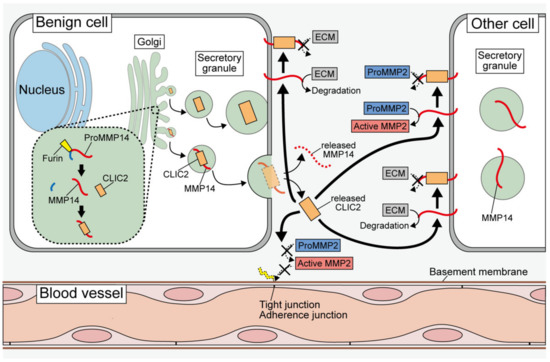 Chloride Intracellular Channel Proteins (CLICs) and Malignant Tumor ...