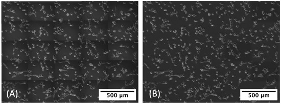 TNTdetect.AI: A Deep Learning Model for Automated Detection and Counting of Tunneling Nanotubes ...