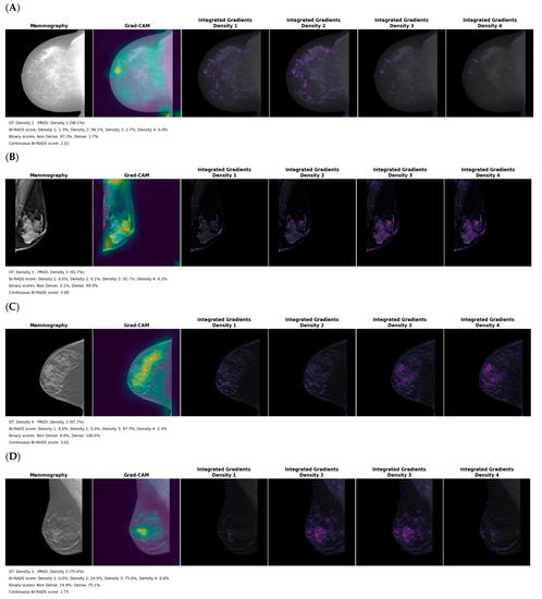 Deep Learning Models for Automated Assessment of Breast Density Using ...