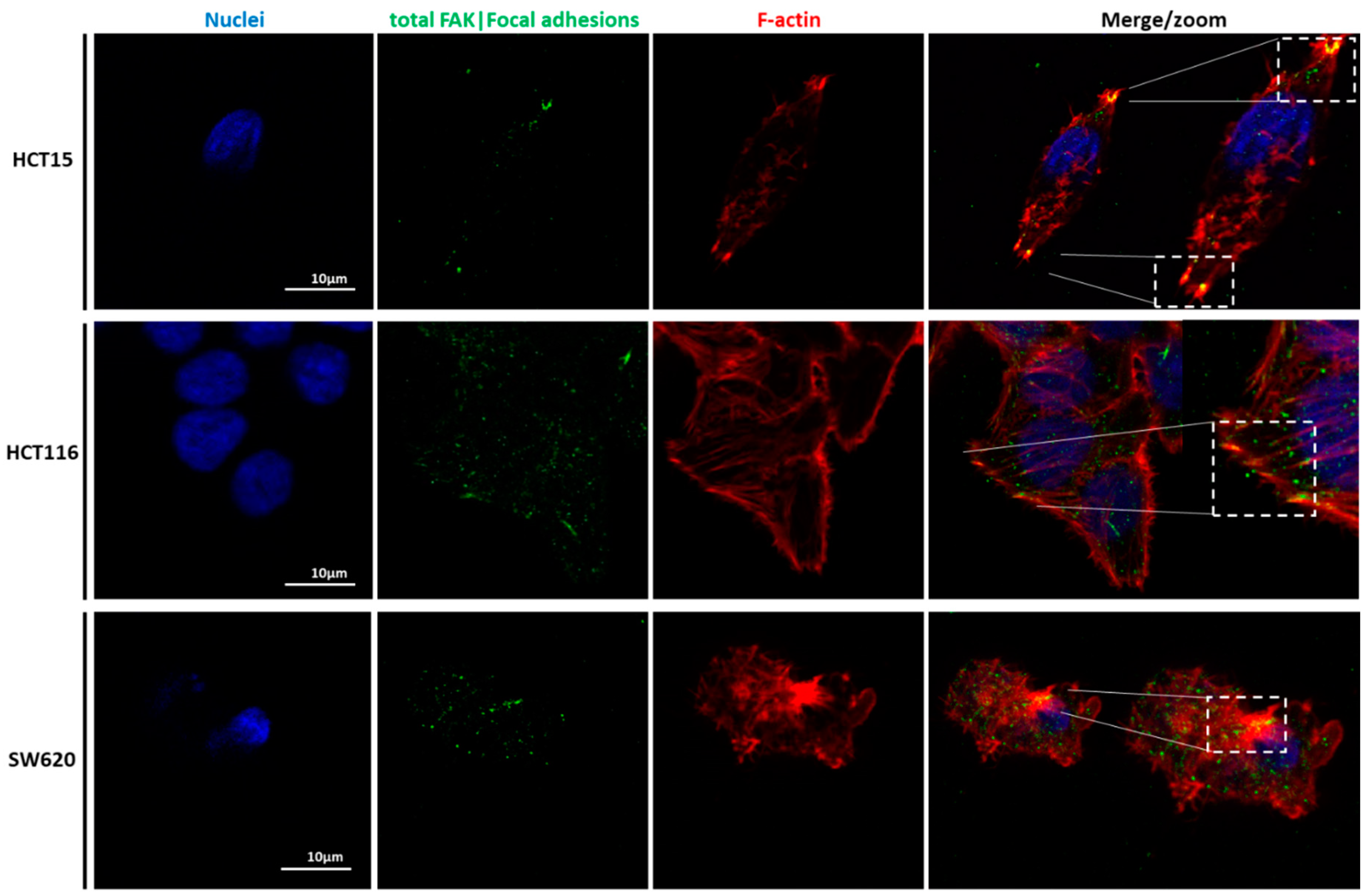 Mechanical Properties of Colorectal Cancer Cells Determined by Dynamic ...