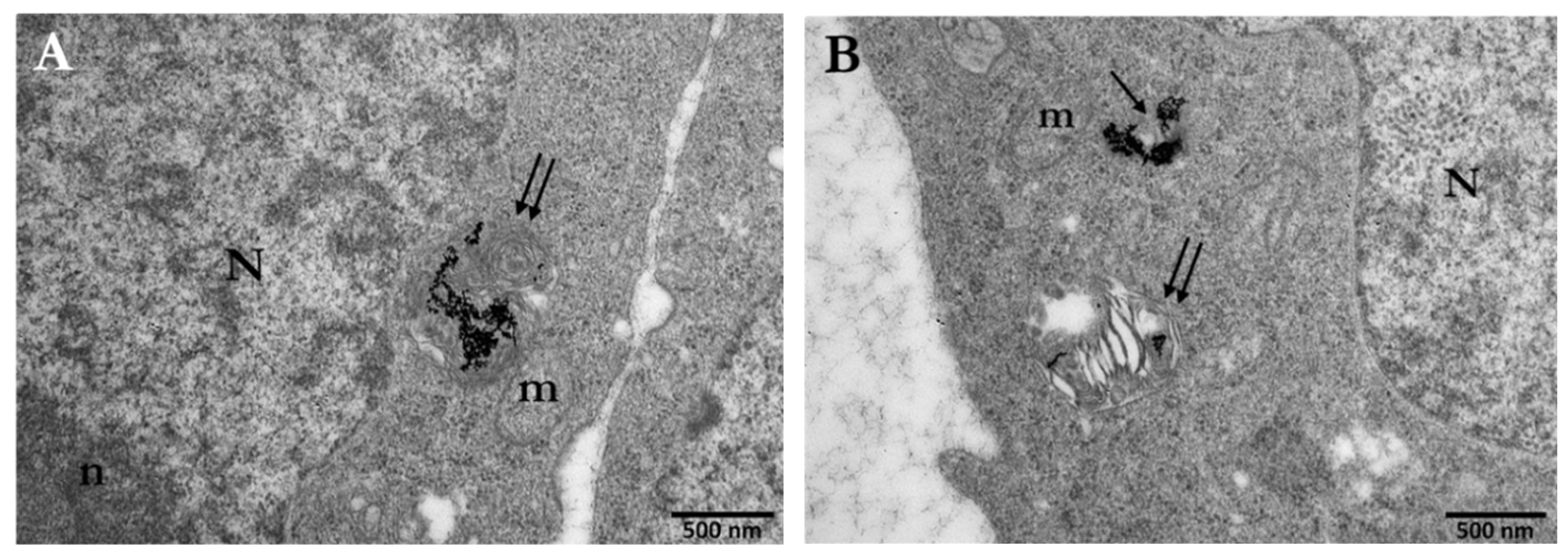 Biological Response of Human Cancer Cells to Ionizing Radiation in ...