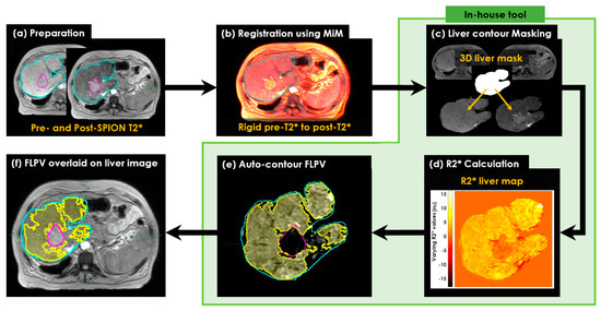 Quantifying Liver Heterogeneity via R2*-MRI with Super-Paramagnetic ...