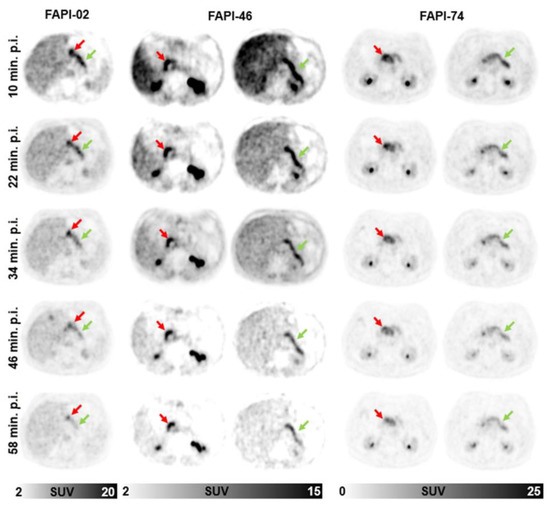 Subclass Analysis of Malignant, Inflammatory and Degenerative Pathologies Based on Multiple ...