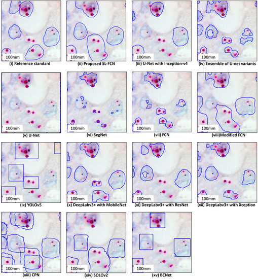 A Soft Label Deep Learning to Assist Breast Cancer Target Therapy and ...