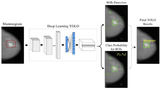 The Role of Deep Learning in Advancing Breast Cancer Detection Using ...