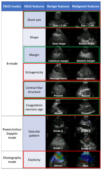 Predicting Malignant Lymph Nodes Using a Novel Scoring System Based on Multi-Endobronchial ...