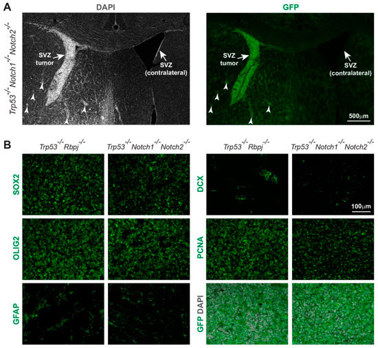 Genetic Inactivation of Notch1 Synergizes with Loss of Trp53 to Induce ...