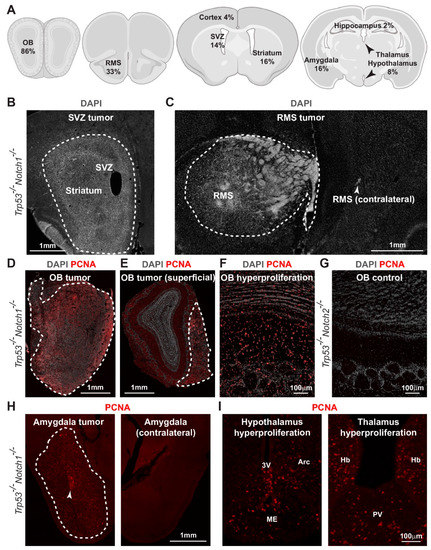 Genetic Inactivation of Notch1 Synergizes with Loss of Trp53 to Induce ...