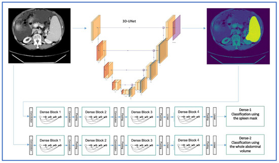 Two-Stage Deep Learning Model for Automated Segmentation and Classification of Splenomegaly