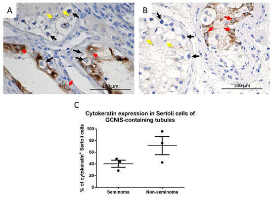 Expression of Intermediate Filaments in the Developing Testis and ...