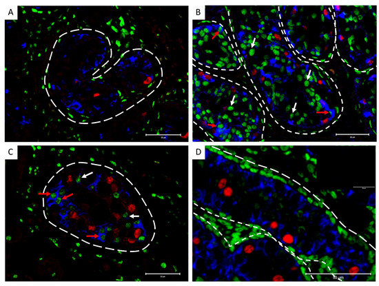 Expression of Intermediate Filaments in the Developing Testis and ...