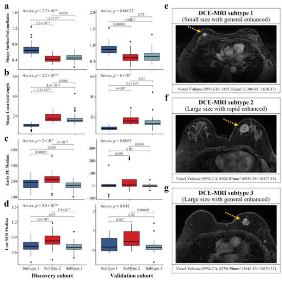 Unsupervised Analysis Based on DCE-MRI Radiomics Features Revealed ...