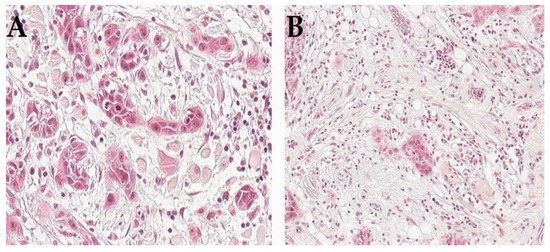 Insight into Classification and Risk Stratification of Head and Neck ...