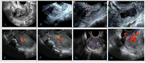 Cancers | Free Full-Text | IETA Ultrasonic Features Combined with GI ...