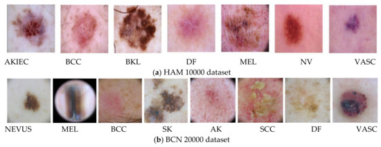 Cancers | Free Full-Text | Integrated Design of Optimized Weighted Deep ...