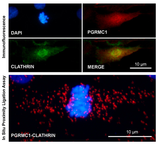 Cancers | Free Full-Text | Insights on the Role of PGRMC1 in Mitotic ...