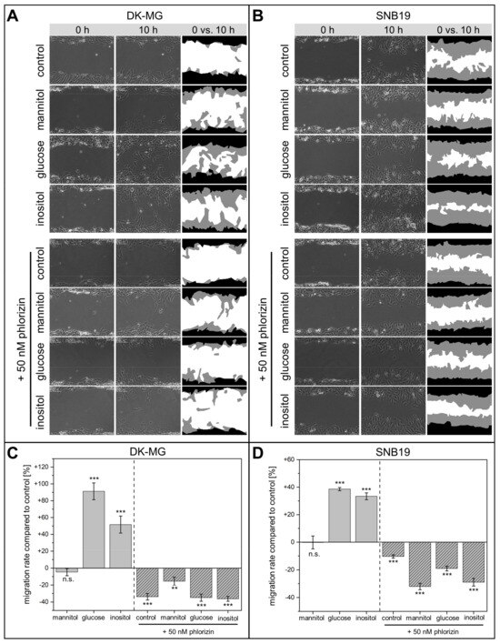 Glucose and Inositol Transporters, SLC5A1 and SLC5A3, in Glioblastoma ...