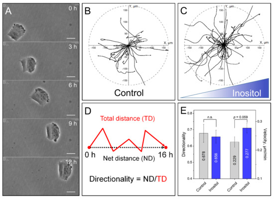 Glucose and Inositol Transporters, SLC5A1 and SLC5A3, in Glioblastoma ...
