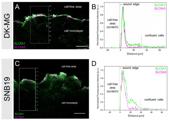 Glucose and Inositol Transporters, SLC5A1 and SLC5A3, in Glioblastoma ...