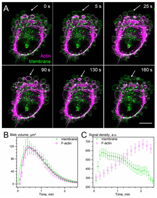 Glucose and Inositol Transporters, SLC5A1 and SLC5A3, in Glioblastoma ...