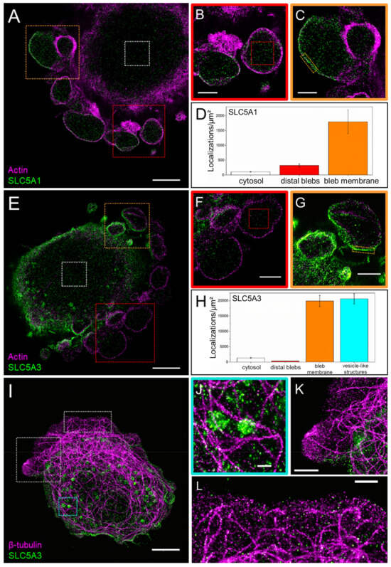 Glucose and Inositol Transporters, SLC5A1 and SLC5A3, in Glioblastoma ...
