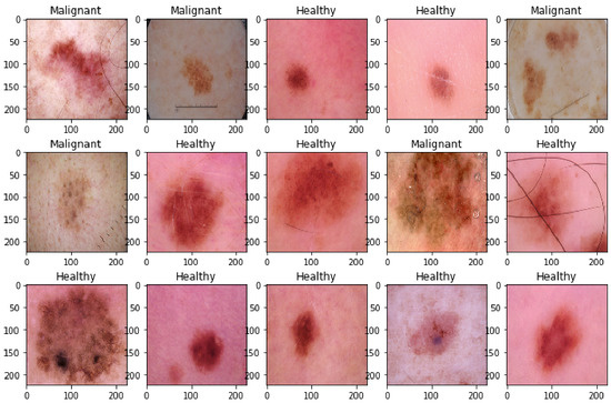 Cancers | Free Full-Text | Attention Cost-Sensitive Deep Learning-Based ...