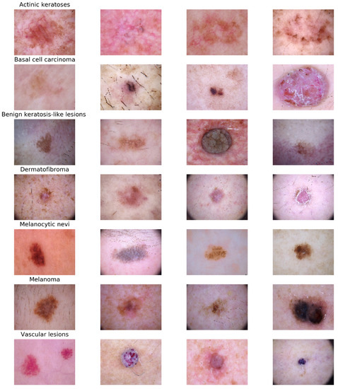 Attention Cost-Sensitive Deep Learning-Based Approach for Skin Cancer ...