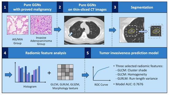 Cancers | Free Full-Text | CT-Based Radiomic Analysis for Preoperative ...
