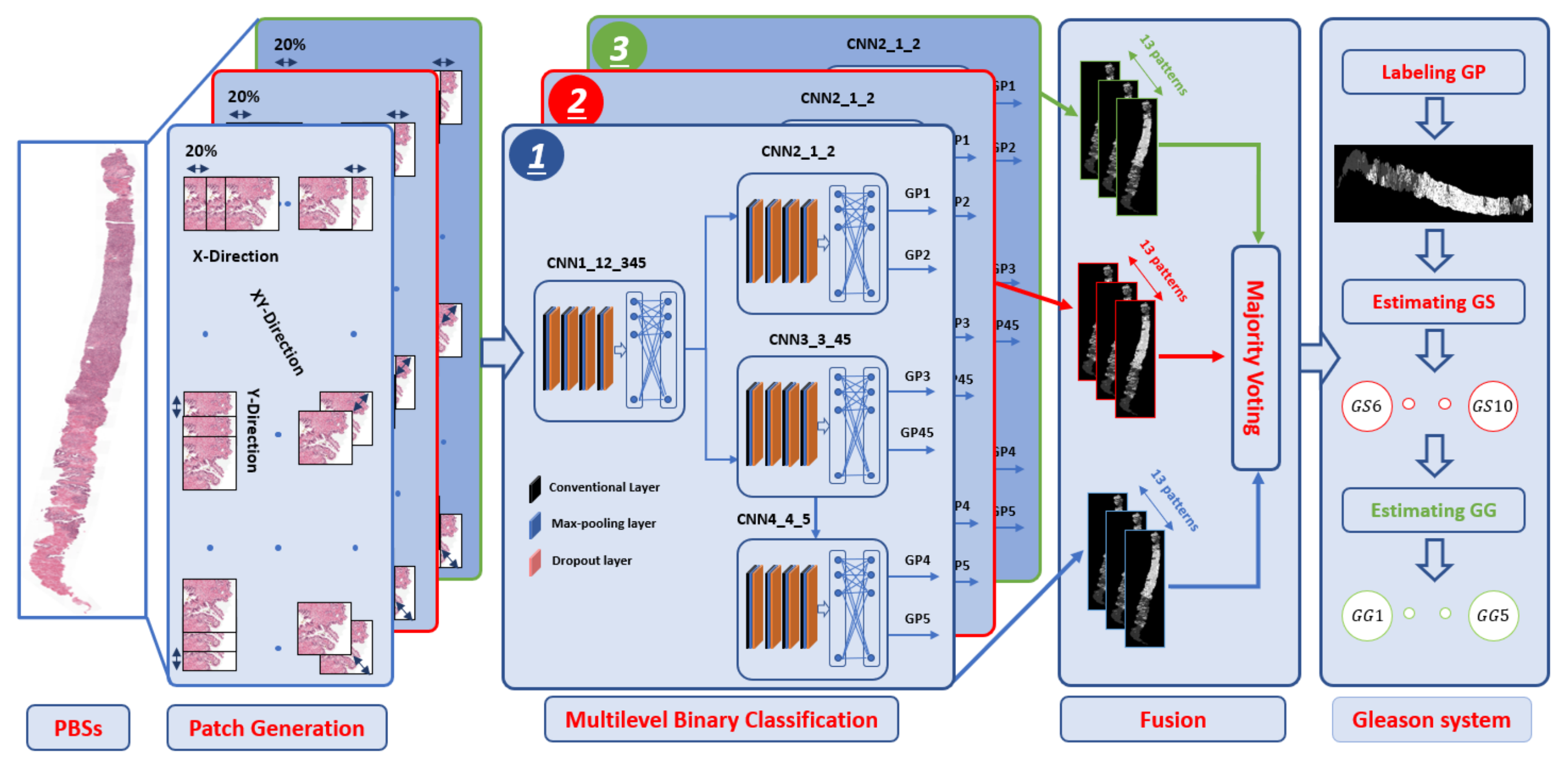 Multi-Stage Classification-Based Deep Learning for Gleason System Grading Using ...